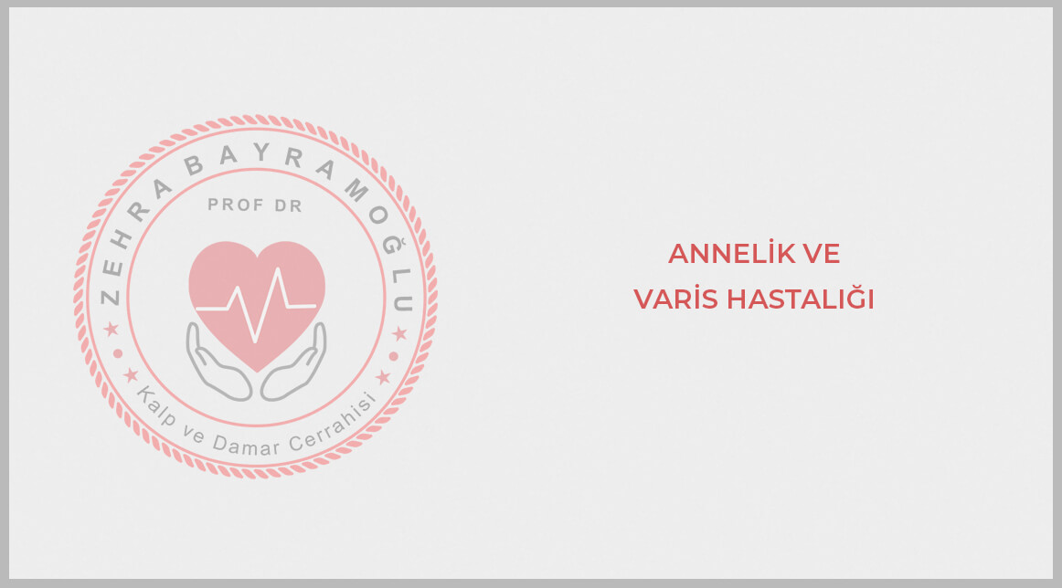 Annelik ve Varis Hastalığı , Hamilelik Ve Varis, Varis Tedavisi