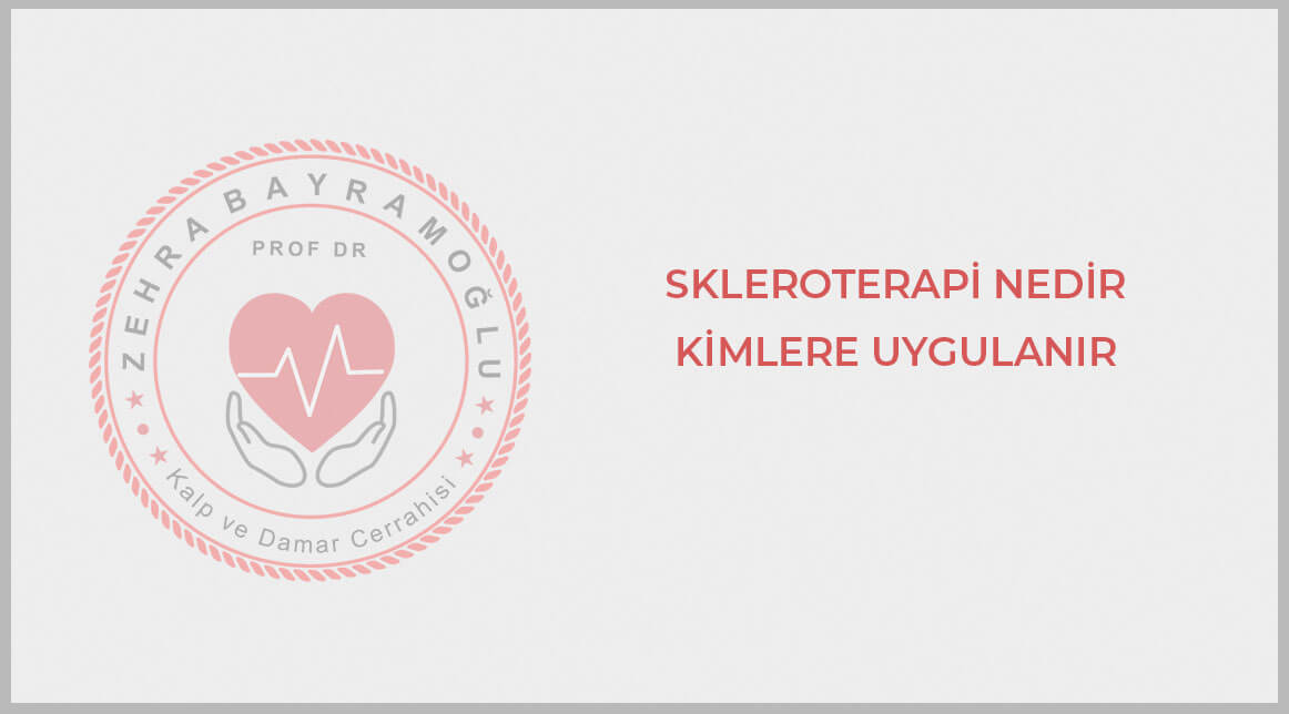 Skleroterapi Nedir ve Kimlere Uygulanır