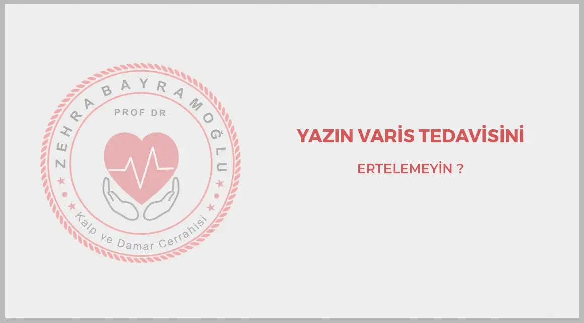 Yazın Varis Tedavisini Ertelemeyin - Varis Tedavileri