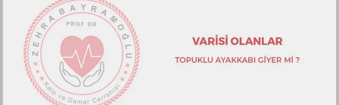 Varisi Olanlar Topuklu Ayakkabı Giyebilir mi - Varis Tedavisi